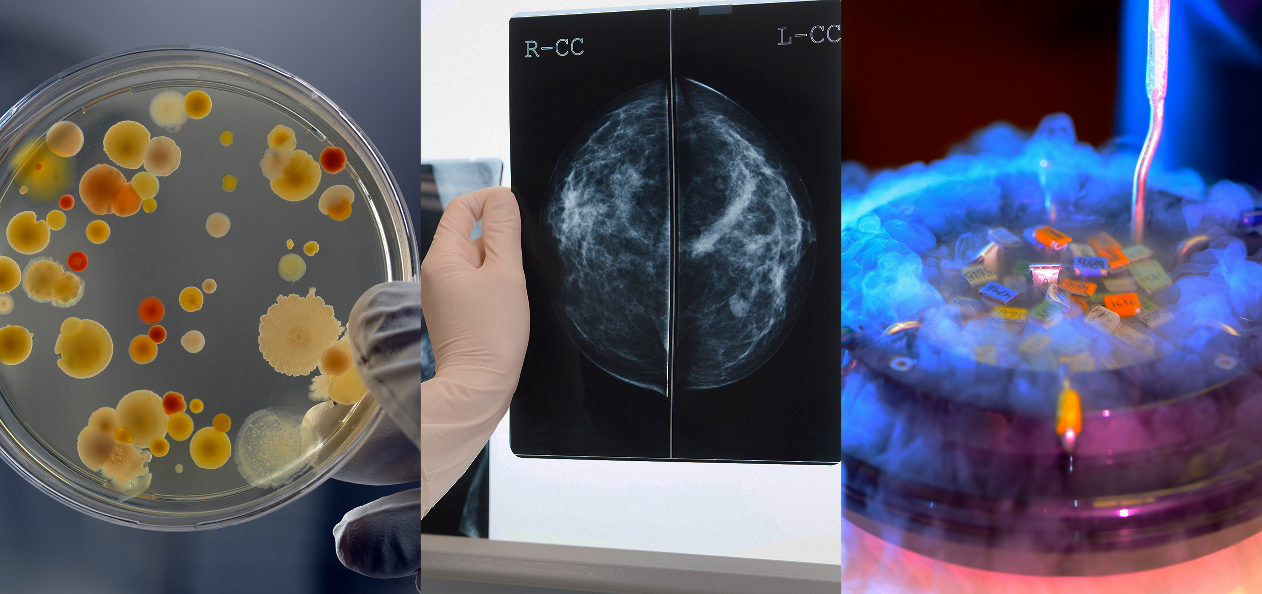 BioANALYSIS | Μικροβιολογικό - Ακτινολογικό Εργαστήριο - Πάτρα